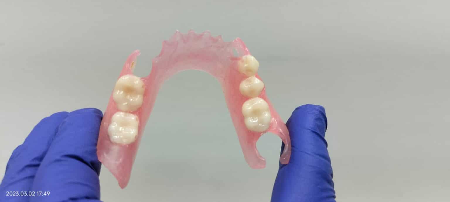 Qué son las prótesis flexible - Ventajas y Desventajas